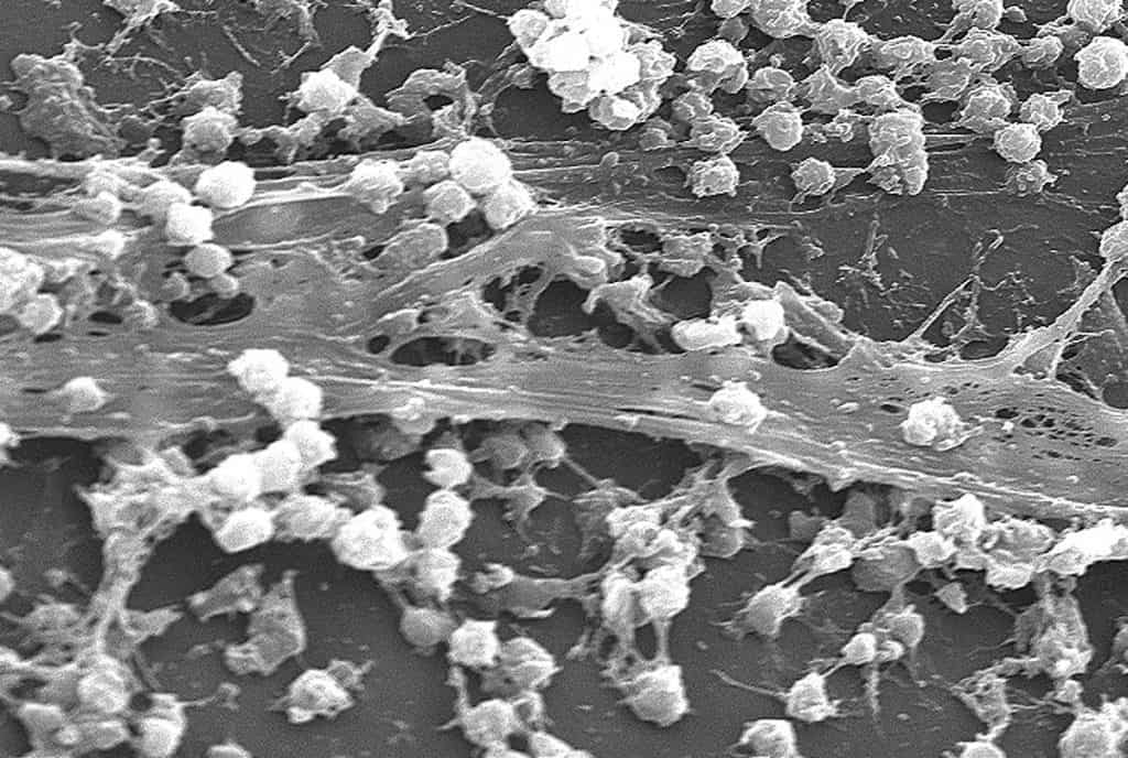 Molecule may help tame virulent bacteria and prevent infection ...