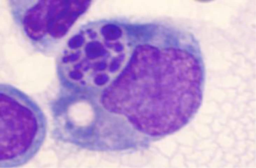 Proper burial of dead cells limits inflammation – BioNews Central