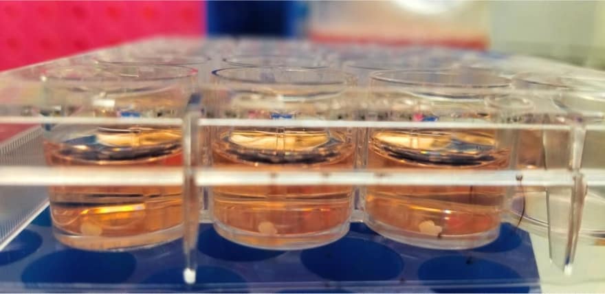 A new milestone in laboratory grown human brain tissue – BioNews Central