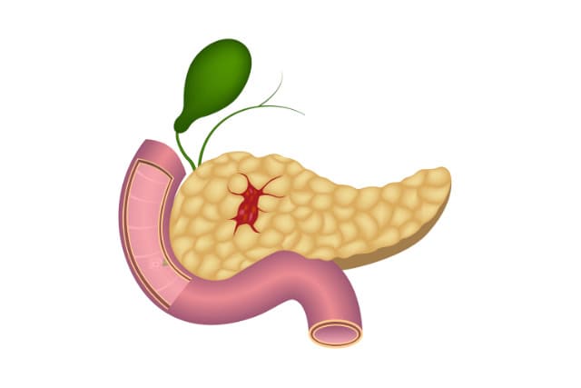 Autologous T cell therapy targeting multiple antigens shows promise ...